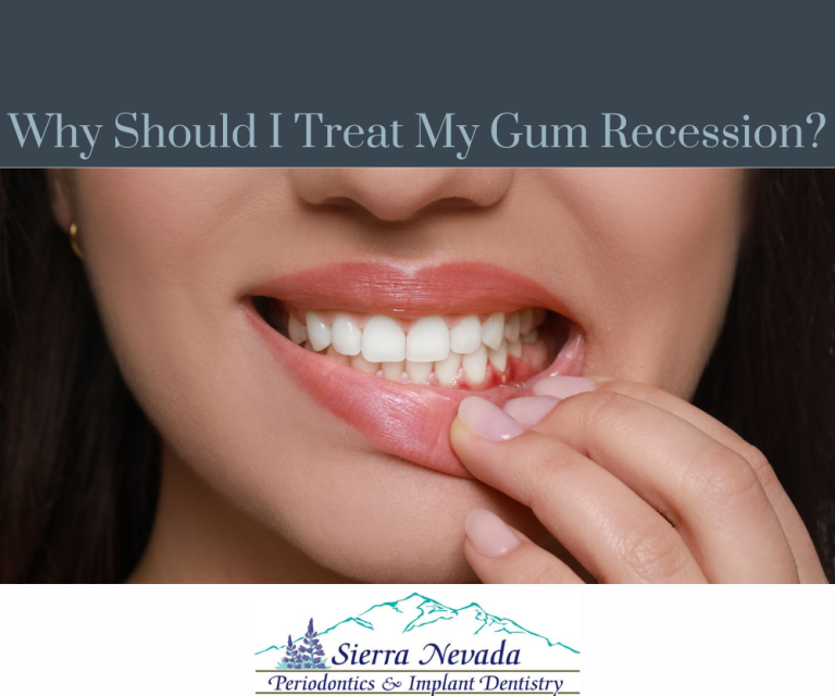 Why Should I Treat My Gum Recession? | Sierra Nevada Periodontics and ...